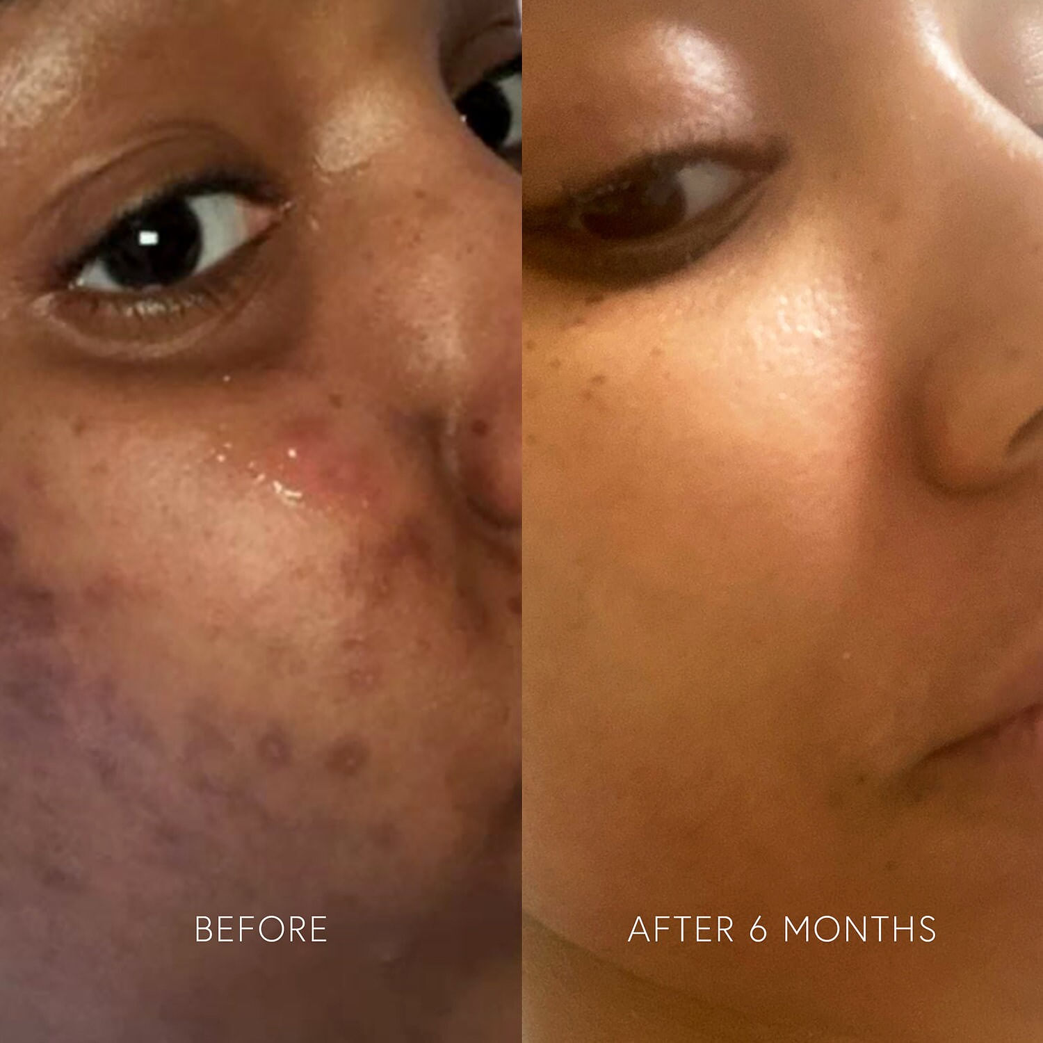 Clarifying Mask | Oprah Daily Shop