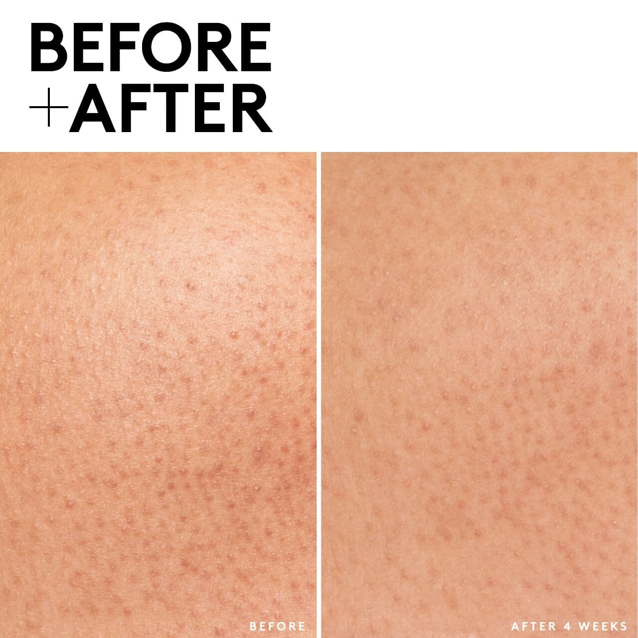 Cherry Dub Triple Action Aha Body Scrub | Oprah Daily Shop