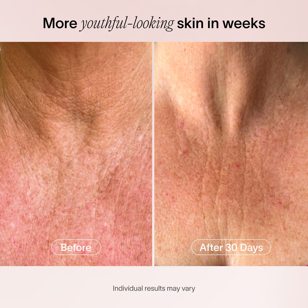 Neck & Chest Rejuvenating Mask | Oprah Daily Shop